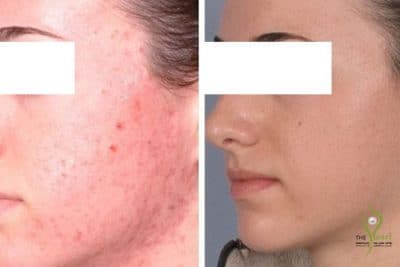 Home - The Pearl Dermatology